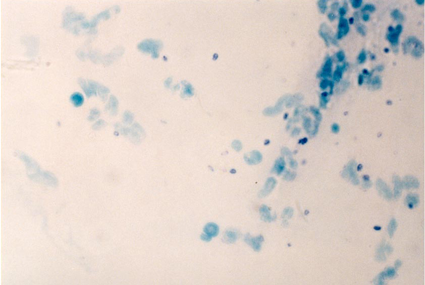 2005 sputum-ypestis-wayson1.jpg